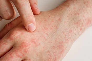 Hospital Pharmacy Technician's Letter